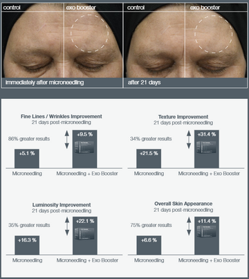 Exo Booster | Dermalogica CA