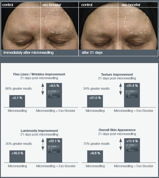 Exo Booster | Dermalogica CA