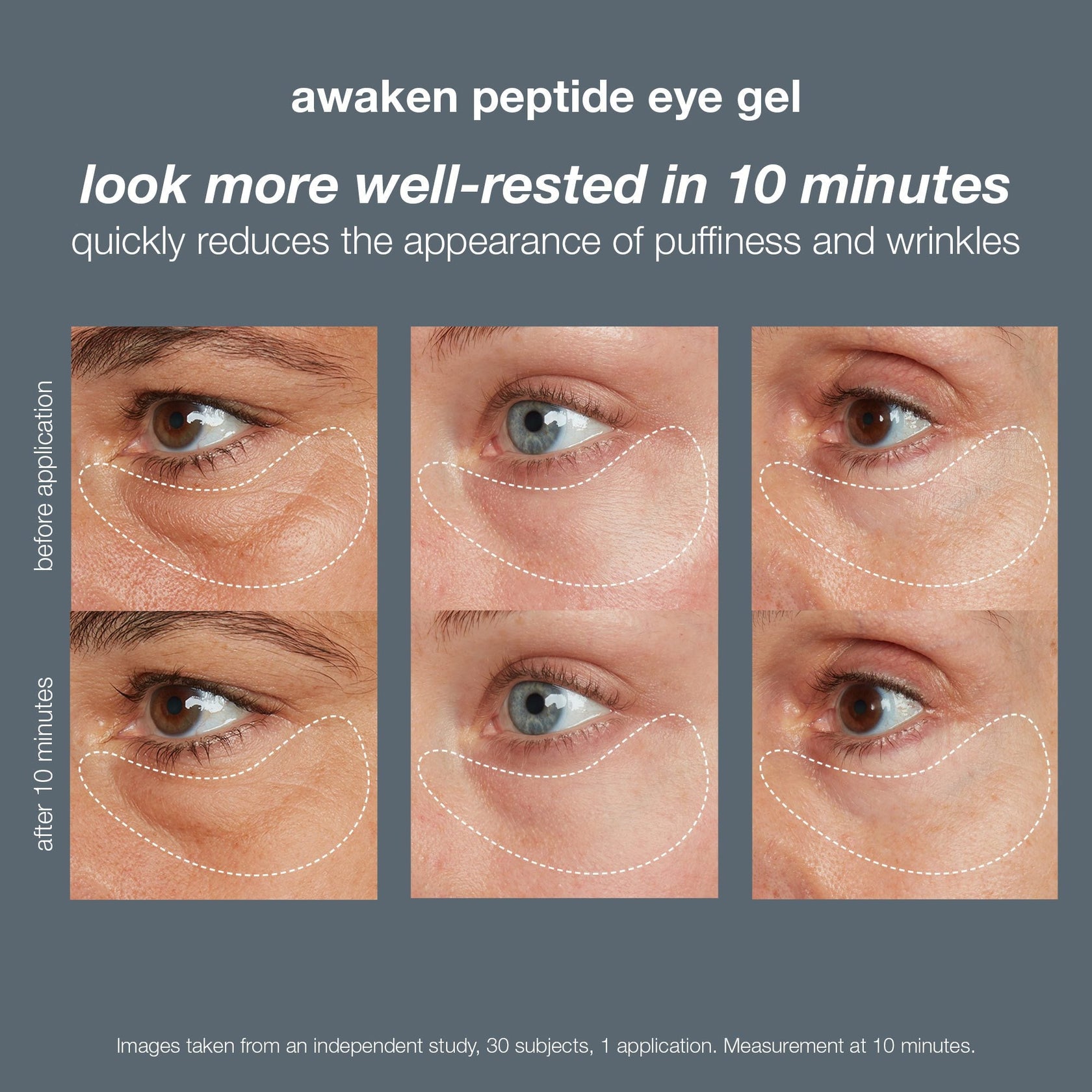 awaken peptide depuffing eye gel | Dermalogica CA
